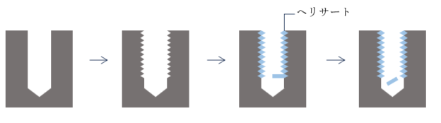 ヘリサートの使い方とは？種類やインサートとの違いも解説